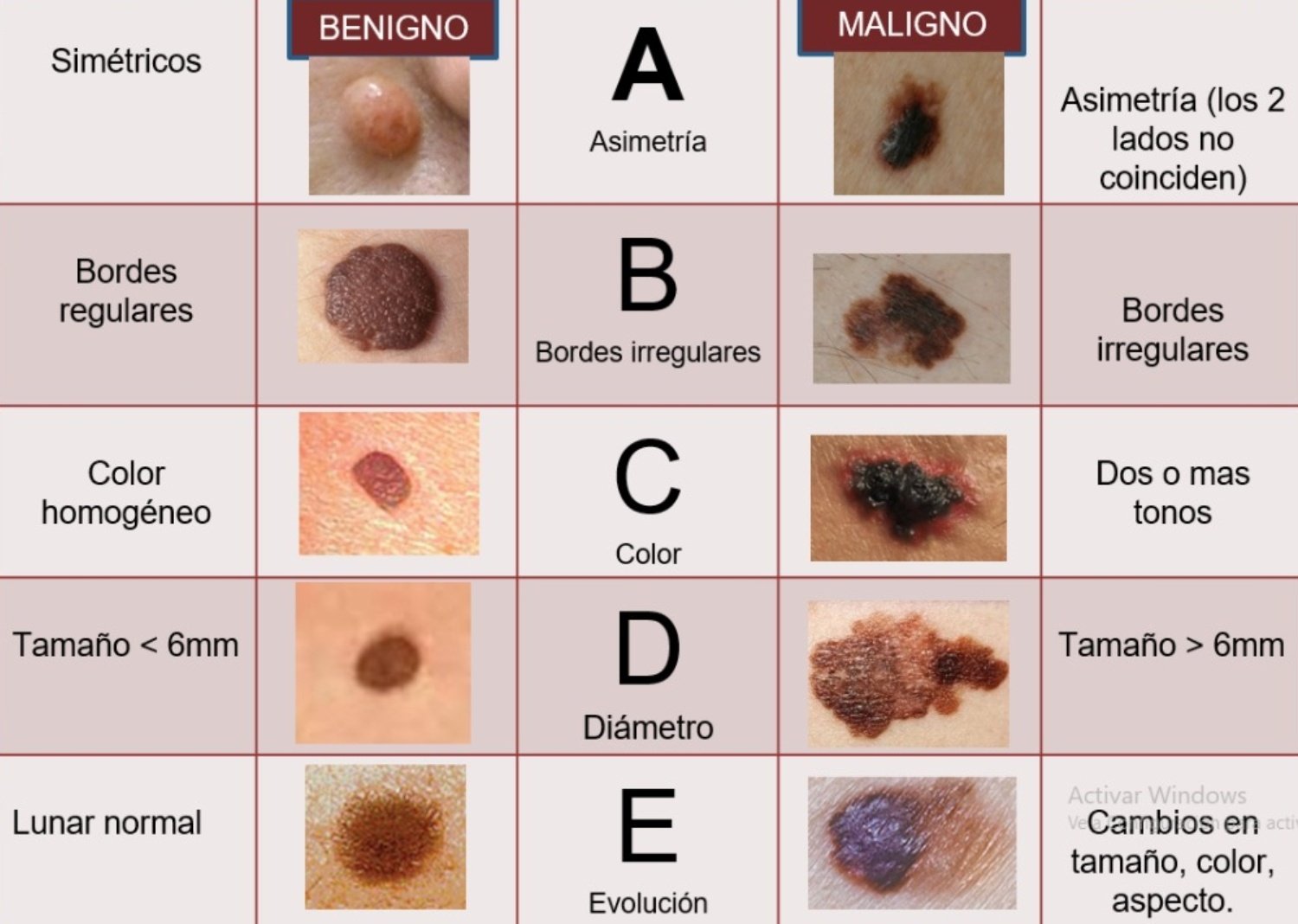 Los lunares y qué cuidado conllevan para la salud - El Diario - Bolivia