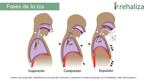 La tos ¿Por qué se debe tener mucho cuidado? - El Diario - Bolivia